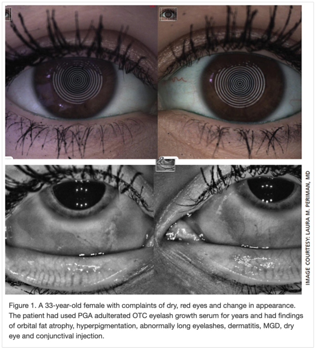 Long Eyelashes, Dry Eyes & Eye Cosmetics with Laura M. Periman, MD